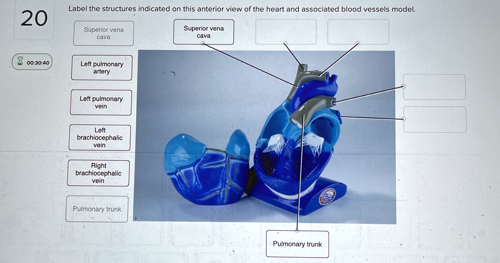 20 Label the structures indicated on this anterior view of the heart ...