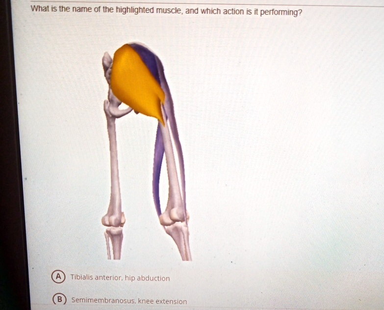 What is the name of the highlighted muscle, and which action is it ...