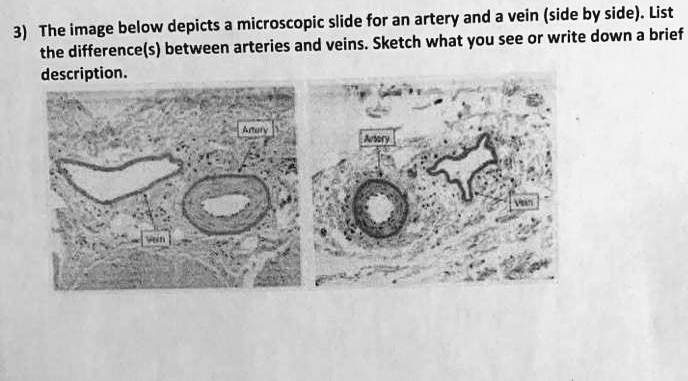 SOLVED: below depicts a microscopic slide for an artery and vein (side ...