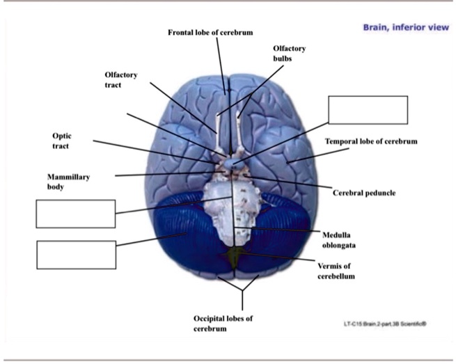 SOLVED: Label the inferior view of the brain Frontal lobe of cerebrum ...