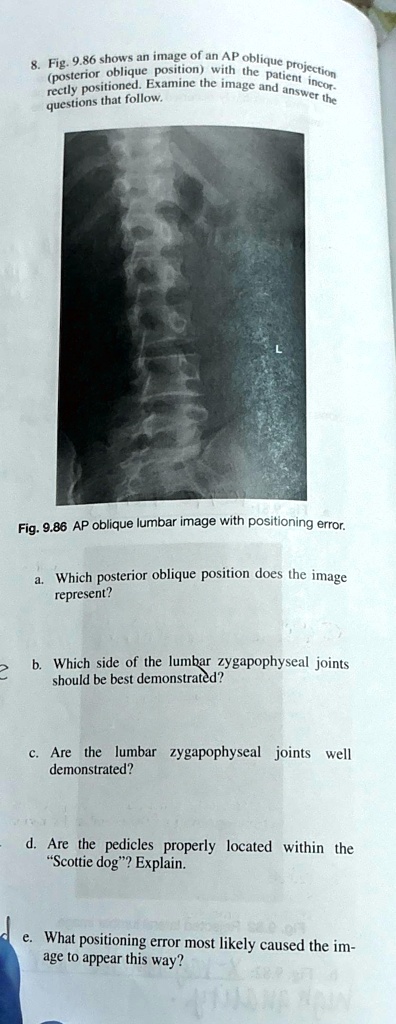 VIDEO solution: Fig. 9.86 shows an image of an AP oblique projection ...