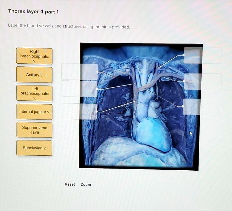 Text: Thorax layer 4 part 1 Label the blood vessels and structures ...