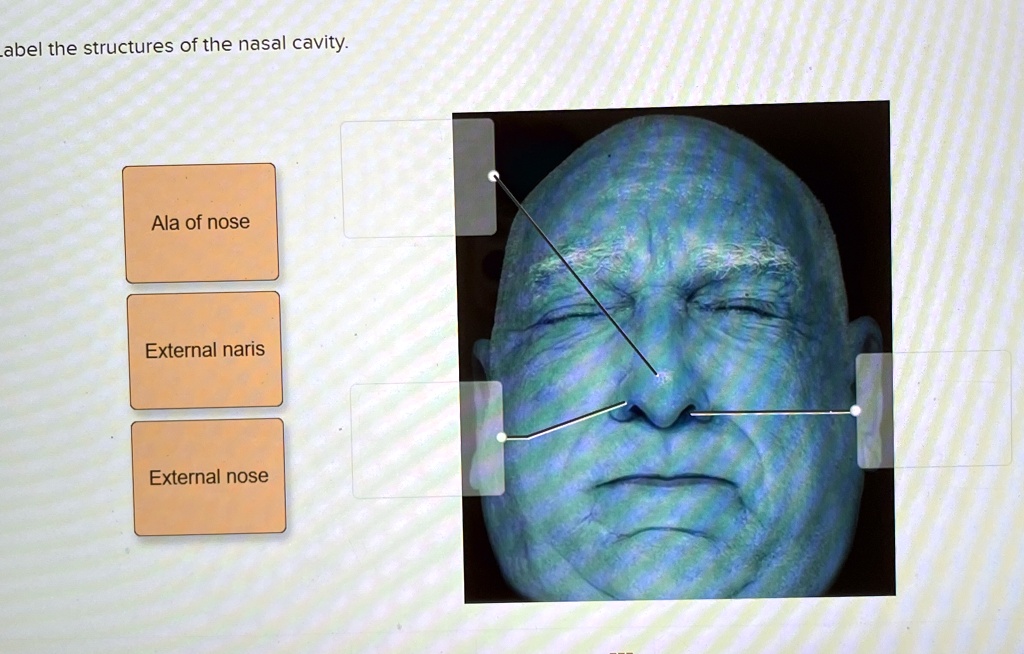 Label the structures of the nasal cavity. Ala of nose External naris ...