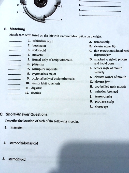 B. Matching Match each term listed on the left with its correct ...