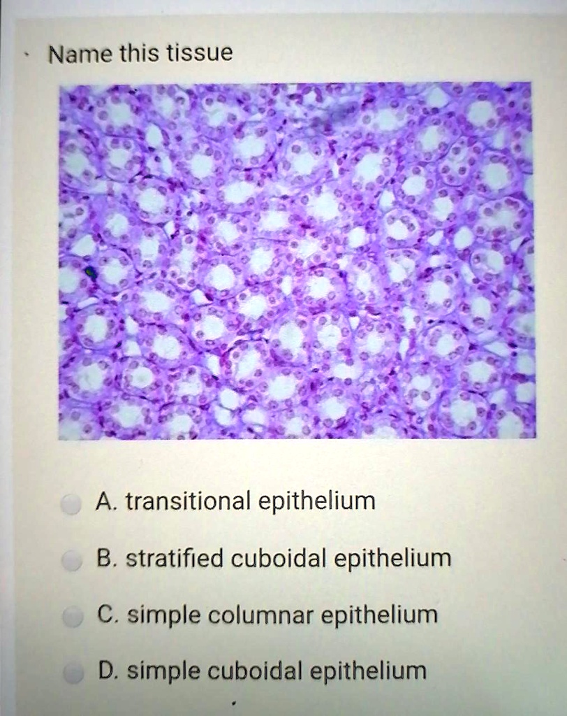 SOLVED: Name this tissue A. transitional epithelium B. stratified cuboidal epithelium C. simple ...