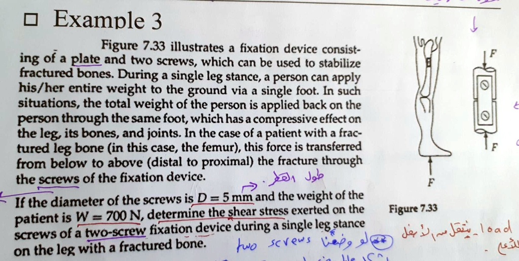 example 3 figure 733 illustrates a fixation device consist ing of a ...