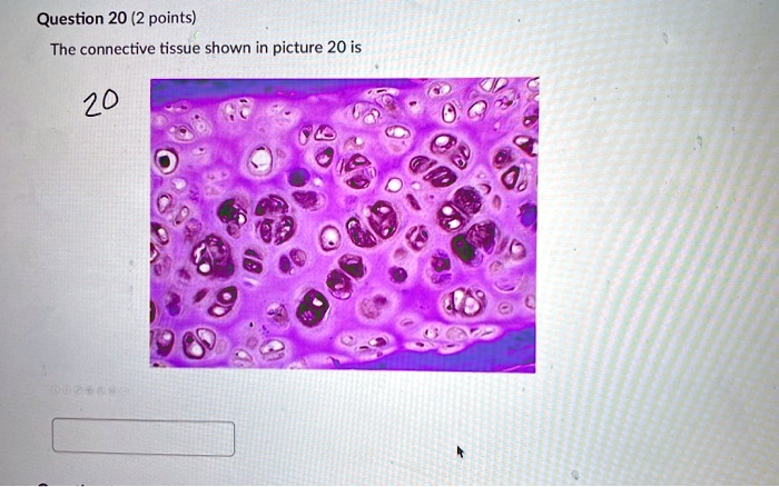 SOLVED: Question 20(2 points) The connective tissue shown in picture 20 ...