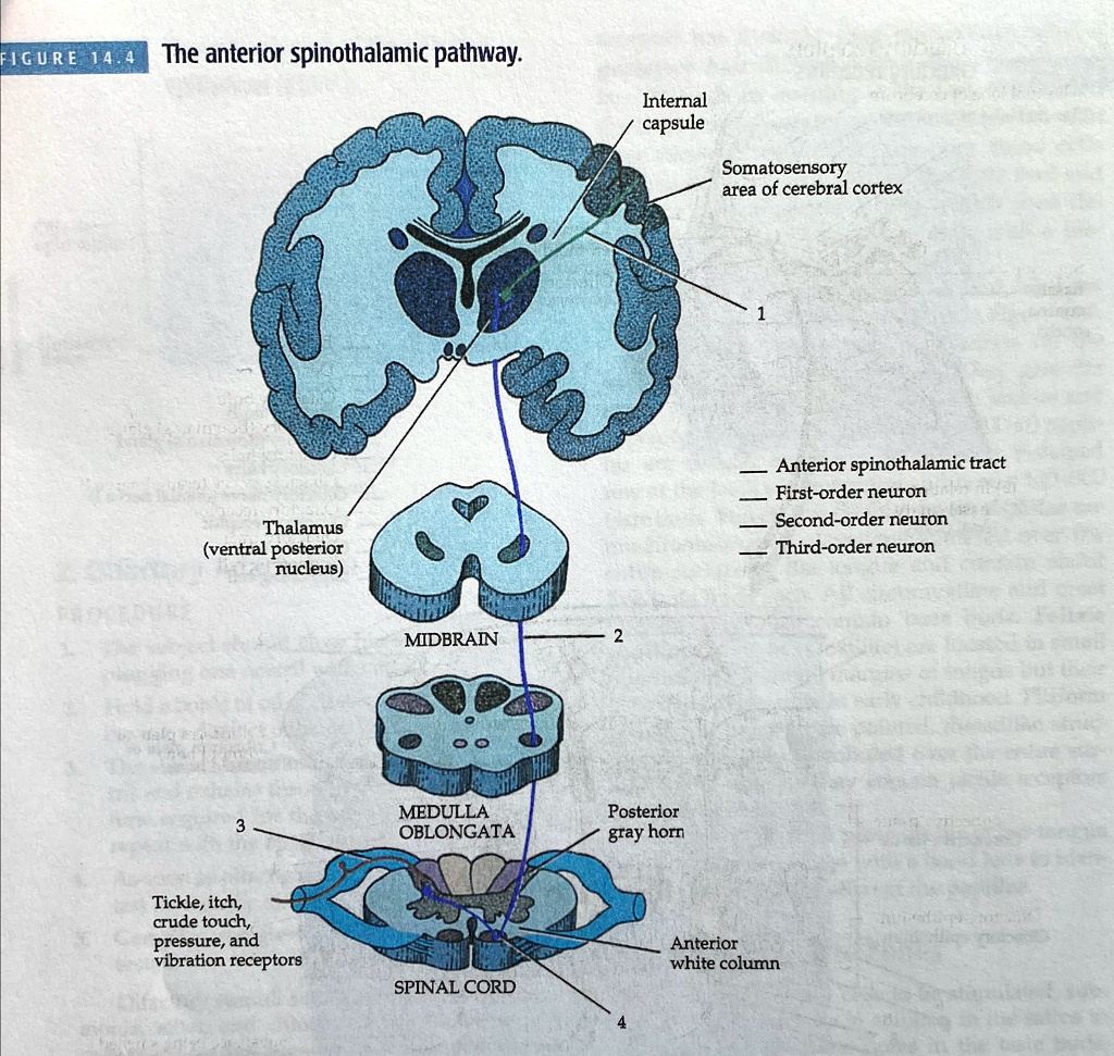 FIGURE 14.4 The anterior spinothalamic pathway. Thalamus (ventral posterior nucleus) 3 MIDBRAIN ...