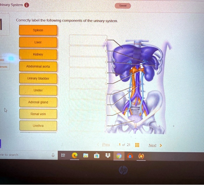 SOLVED: Correctly label the following components of the urinary system ...