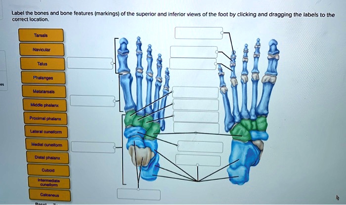 SOLVED: Label the bones and bone features (markings) of the superior ...