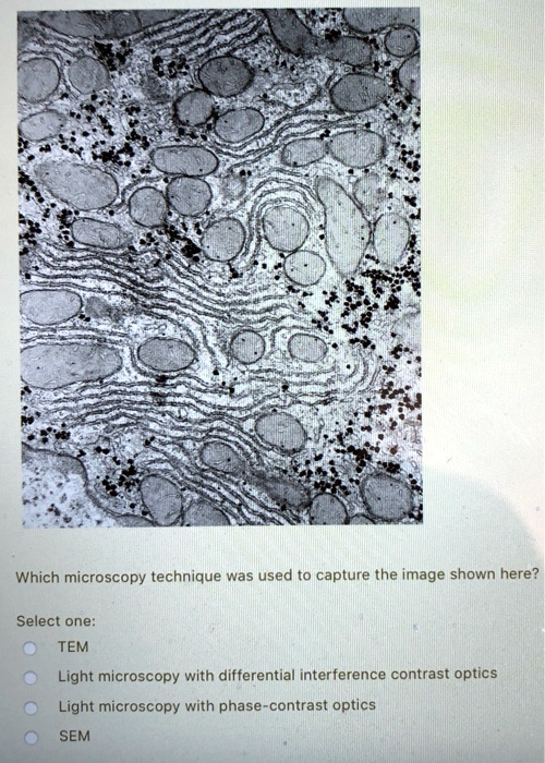 which microscopy technique was used to capture the image shown here ...