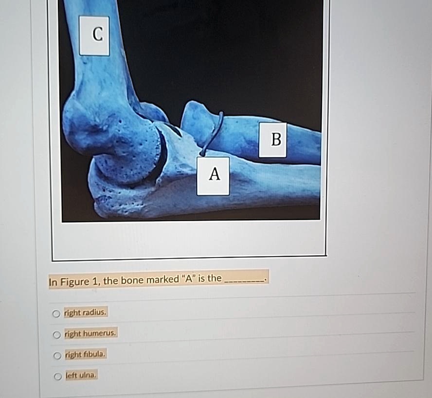 In Figure 1, the bone marked "A" is the O right radius. O right humerus ...