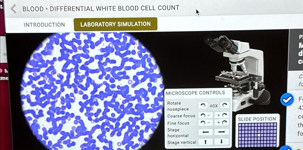 SOLVED: BLOOD DIFFERENTIAL WHITE BLOOD CELL COUNT INTRODUCTION LABORATORY SIMULATION MICROSCOPE ...