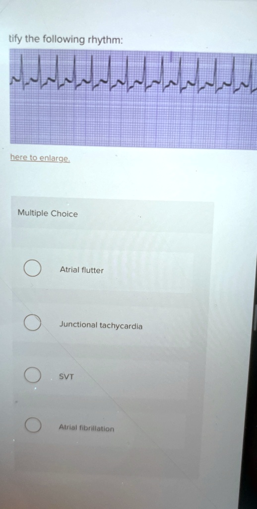tify the following rhythm here to enlarge multiple choice atrial flutter junctional tachycardia ...