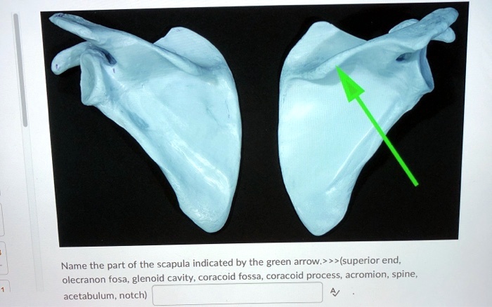 SOLVED: Name the part of the scapula indicated by the green arrow ...