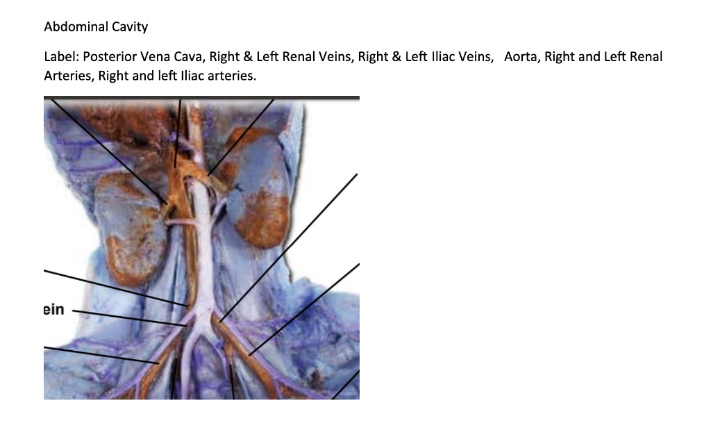 SOLVED: Abdominal Cavity Label: Posterior Vena Cava, Right Left Renal ...