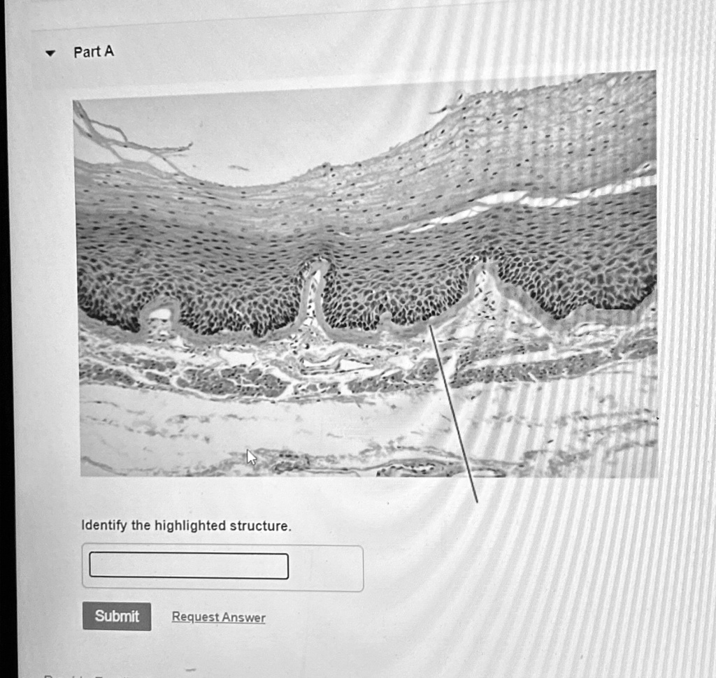 SOLVED: Part A Identify the highlighted structure. SOLVED: Part A Identify the highlighted structure.