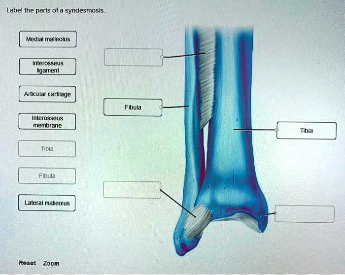 SOLVED: Label the parts of a syndesmosis Medial malleolus Interosseous ...