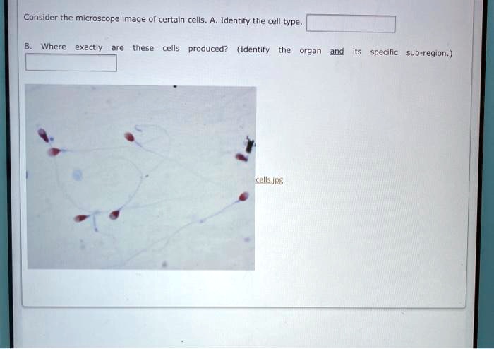 consider the microscope image 0f certain cells identify the cell type ...