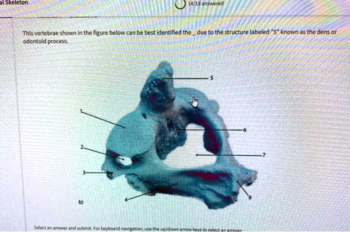 ai skeleton this vertebrae shown in the figure below can be best ...
