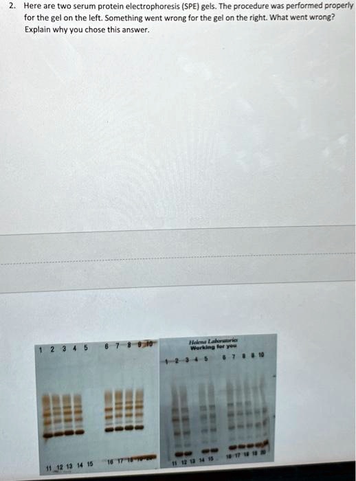 SOLVED: Here are two serum protein electrophoresis(SPE) gels.The ...