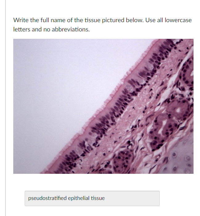 Write the full name of the tissue pictured below. Use all lowercase ...