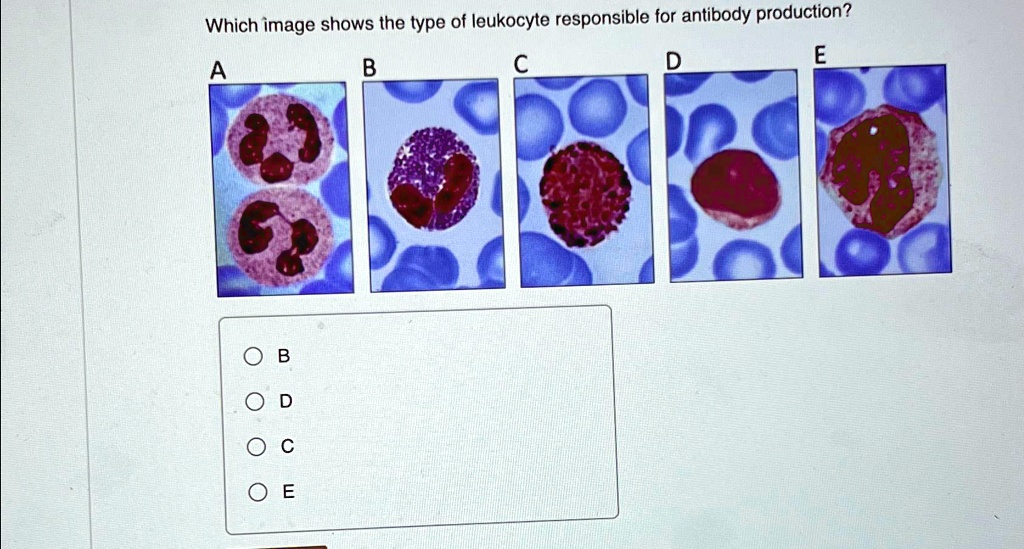 Which image shows the type of leukocyte responsible for antibody ...