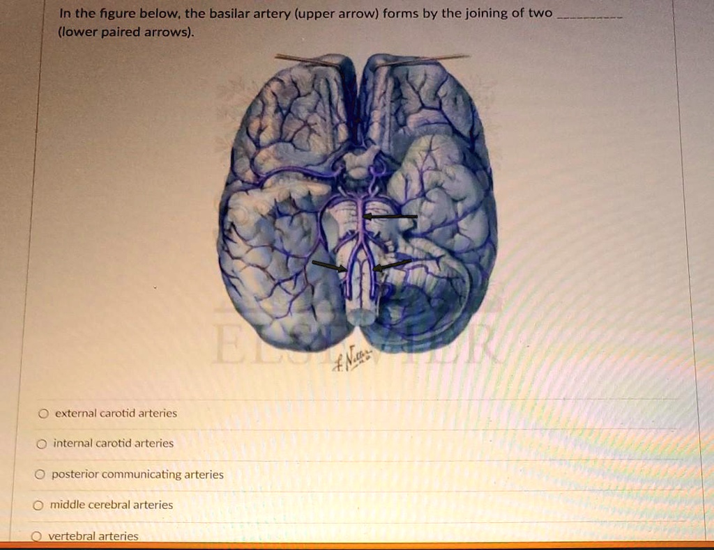 SOLVED: In the figure below, the basilar artery (upper arrow) forms by ...