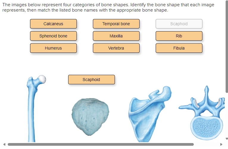 The images below represent four categories of bone shapes. Identify the ...