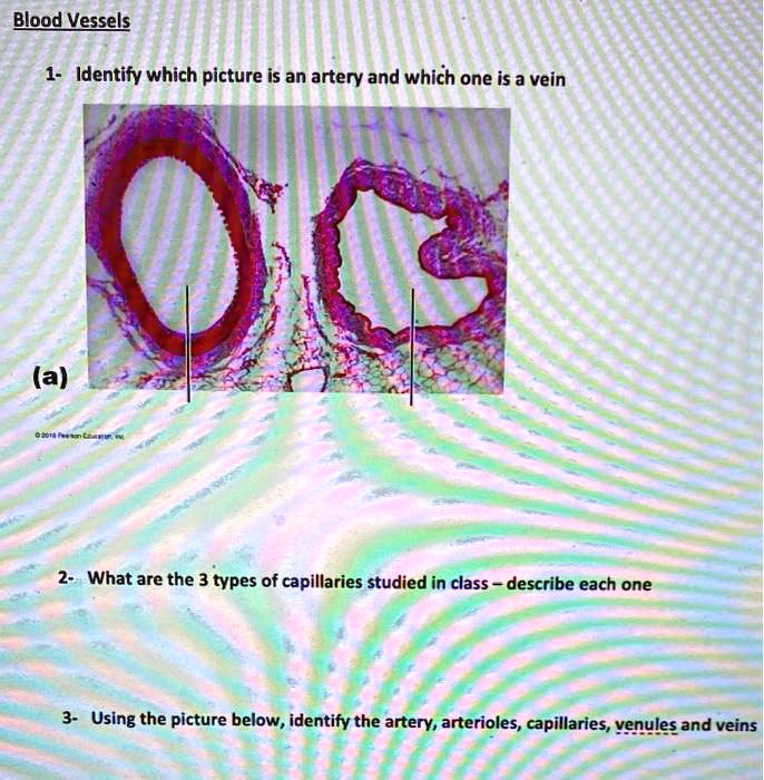 SOLVED: Identify which picture is an artery and which one is a vein. (a ...