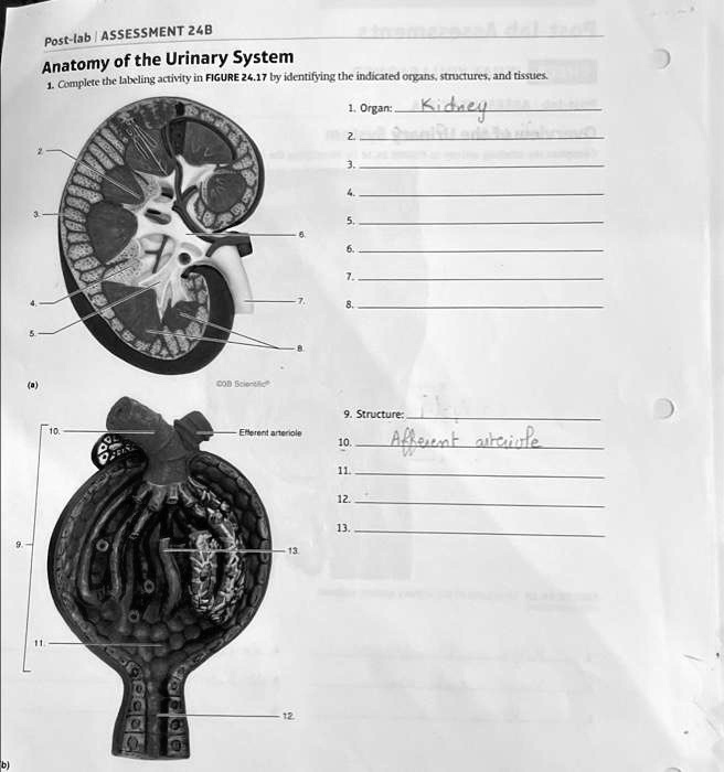 SOLVED: Texts: Post-lab/ASSESSMENT 24B Anatomy of the Urinary System 1 ... SOLVED: Texts: Post-lab/ASSESSMENT 24B Anatomy of the Urinary System 1 ...