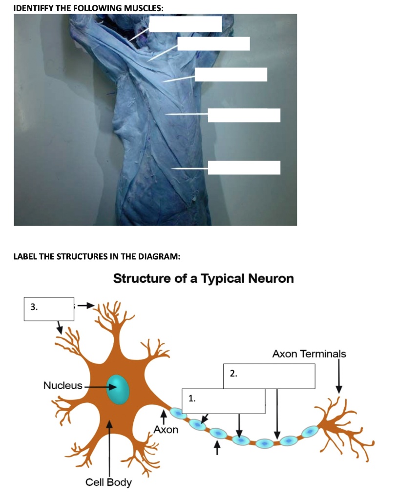 Solved: Identify The Following Muscles Label The Structures In The