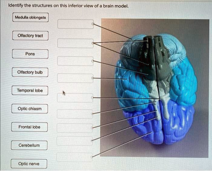 SOLVED: Identify the structures on this inferior view of a brain model ...