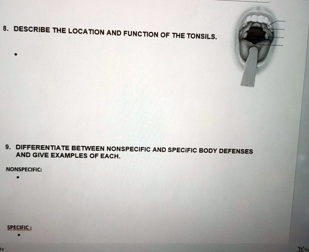 SOLVED: Assignment 8. DESCRIBE THE LOCATION AND FUNCTION OF THE TONSILS ... SOLVED: Assignment 8. DESCRIBE THE LOCATION AND FUNCTION OF THE TONSILS ...