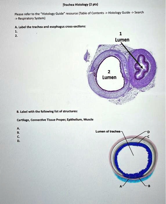 Trachea Histology (2 pts) Please refer to the Histology Guide resource ...