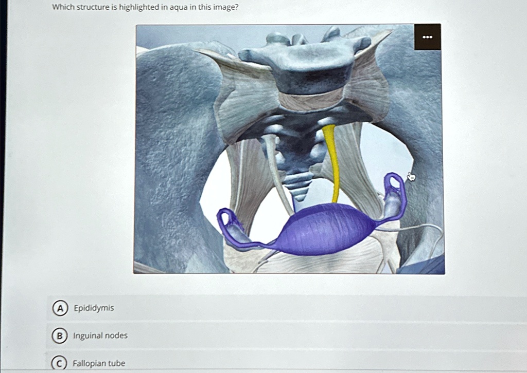 Which structure is highlighted in aqua in this image? A...