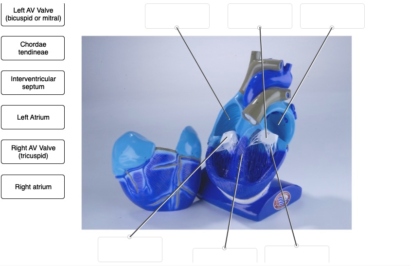 SOLVED: 'Label the structures indicated on this anterior view of the ...