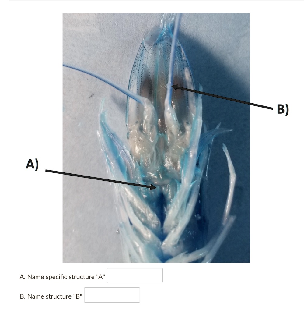 SOLVED: B) A) Name specific structure "A' By Name structure "B"