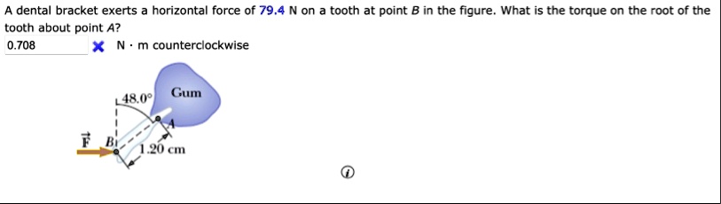 a dental bracket exerts a horizontal force of 794 n on a tooth at point ...