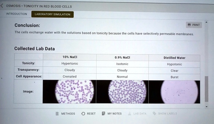 SOLVED: Text: OSMOSIS TONICITY IN RED BLOOD CELLS Introduction Laboratory Simulation Waene ...