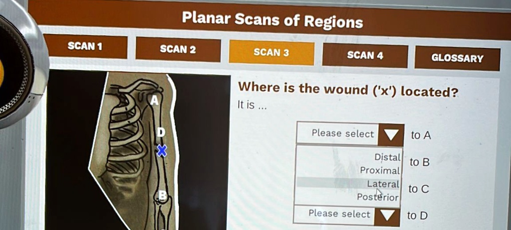 Planar Scans of Regions SCAN 1 Where is the wound ('x') located? It is ... able[[Please select ...