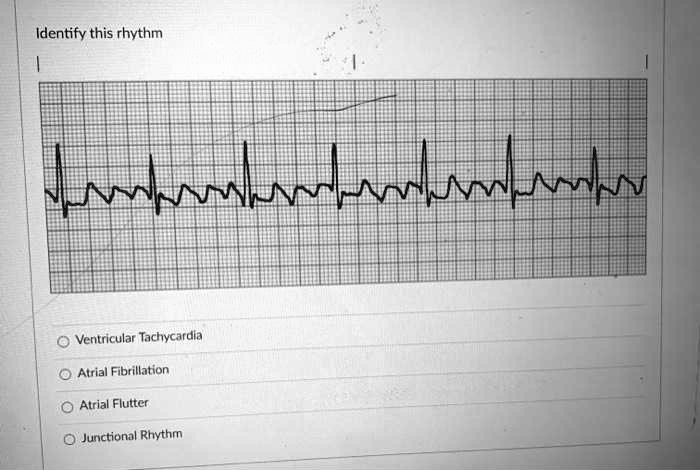 identify this rhythm ventricular tachycardia atrial fibrillation atrial ...