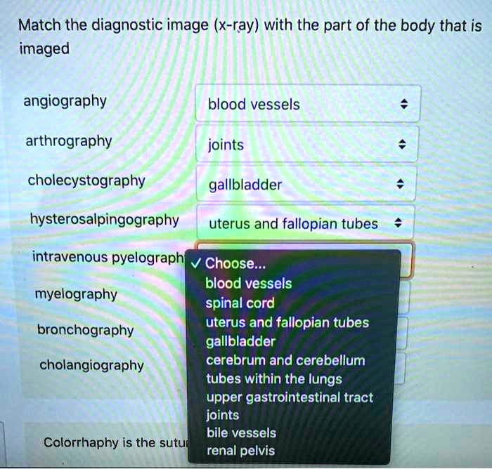 Match the diagnostic image (x-ray) with the part of the body that is ...