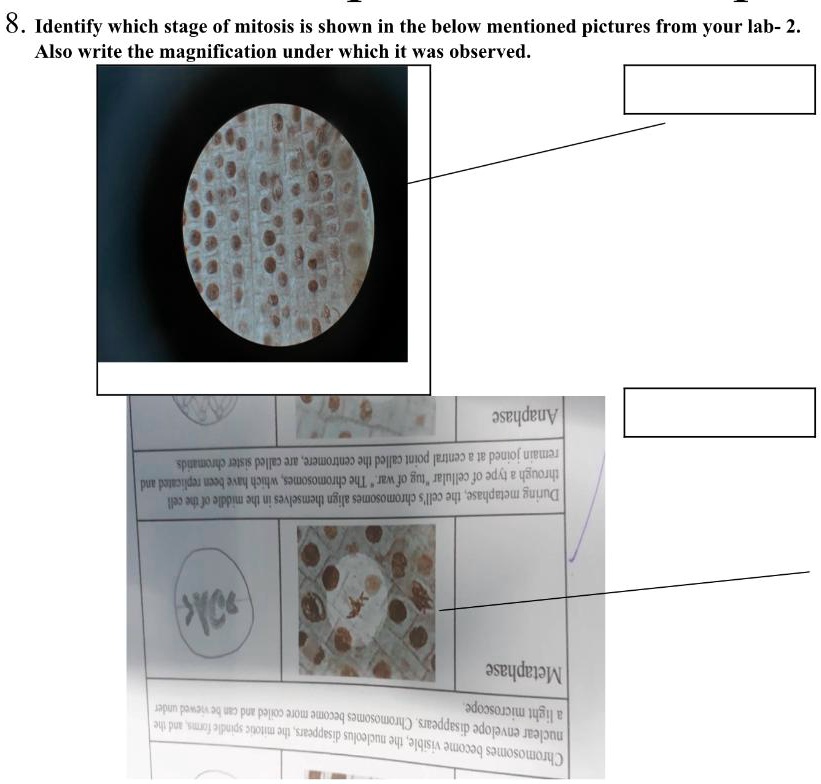 Chromosomes become visible, the nucleolus disappears, the mitotic ...