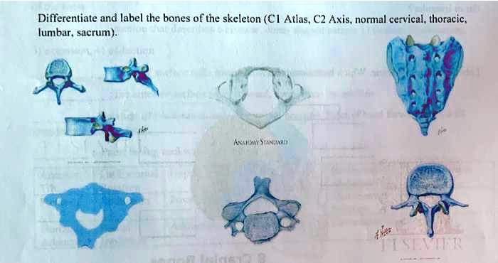 SOLVED: Differentiate and label the bones of the skeleton: C1 Atlas, C2 ...