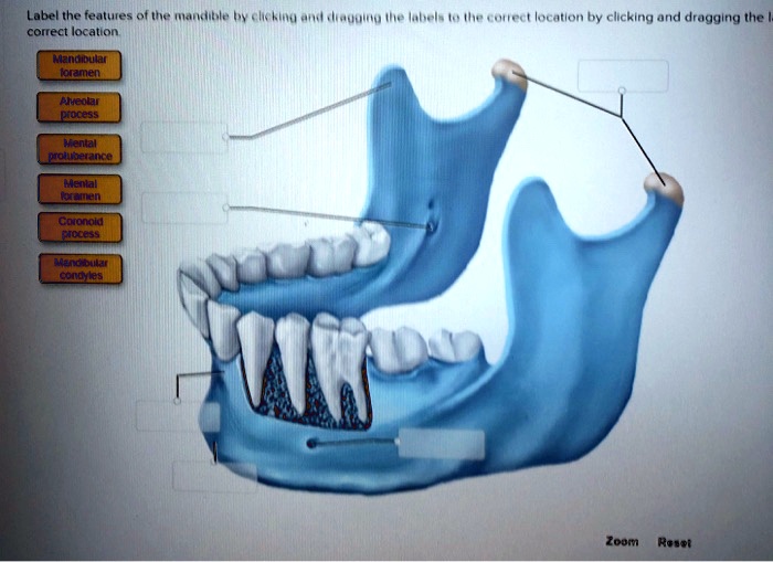 label the features of the mandible by clicking and dragging the labels ...