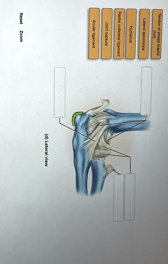 Tendon of biceps brachii (cut) Lateral epicondyle Humerus Radial ...