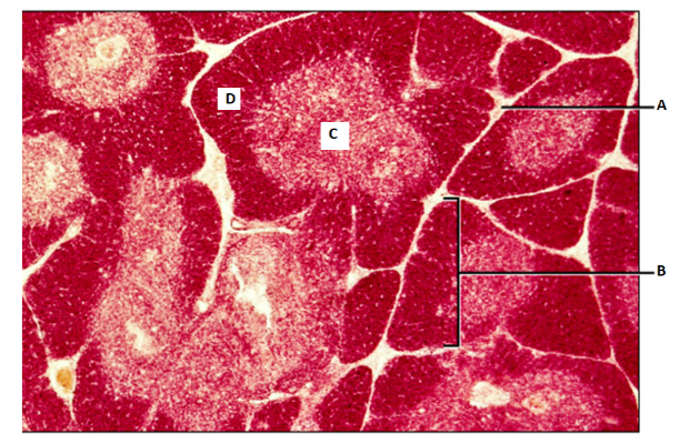 SOLVED: Name the connective tissue structure at A. Question 3 options ...