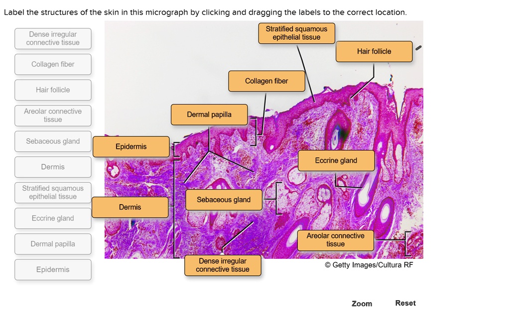 Label the structures of the skin in this micrograph by clicking and ...