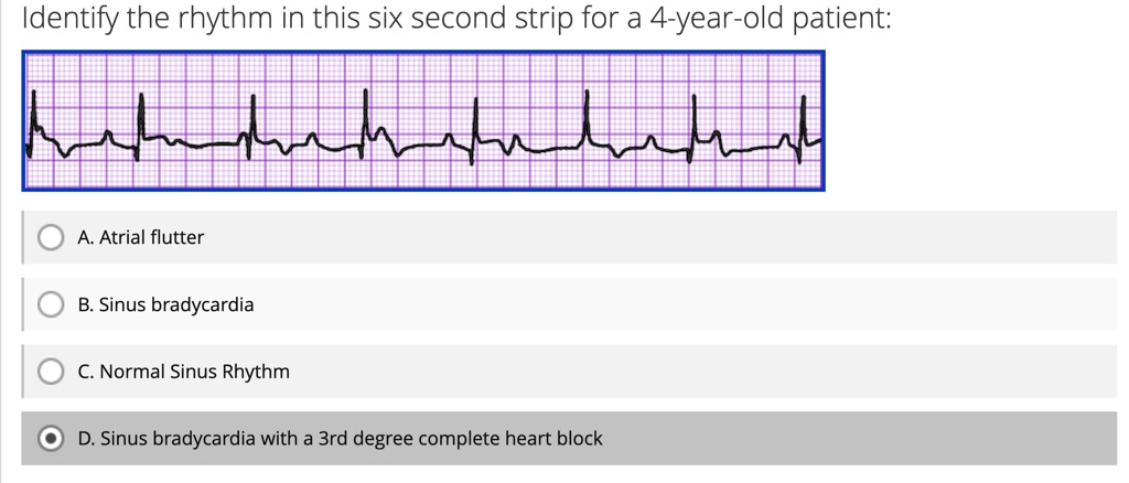 identify the rhythm in this six second strip for a 4 year old patient a ...